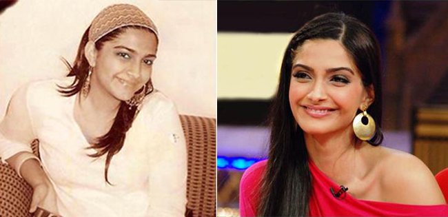 Sonam Kapoor's Journey From Fat To Fit